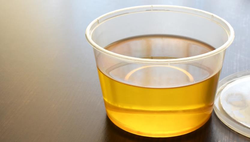 How to Dispose of Cooking Oil? - Easy and Smart Ways | London Rubbish ...